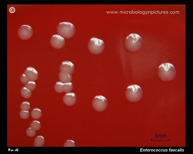 Colonies of Enterococcus faecalis on agar plate. Enterococcus faecalis colonies on blood agar in ...